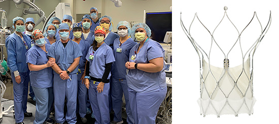 Sparrow is first in nation to implant new heart valve | University of ...